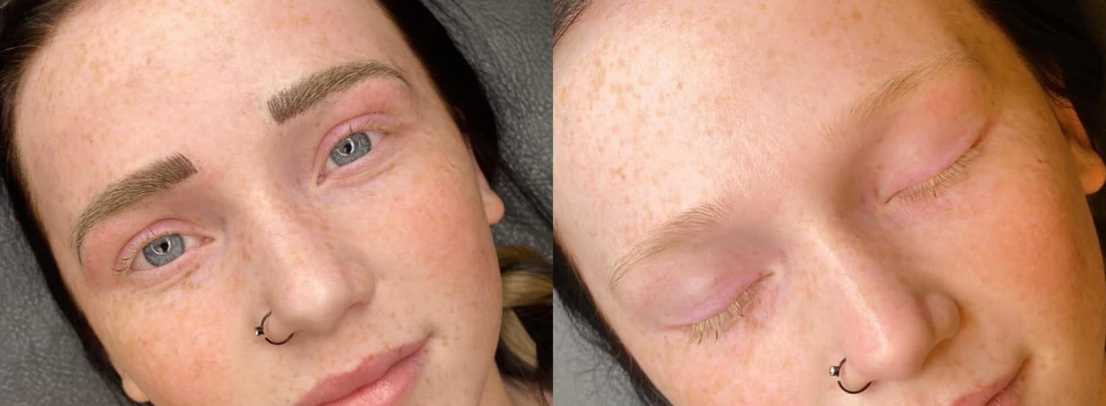Microblading North Ogden | Advanced Electrolysis And MedSpa